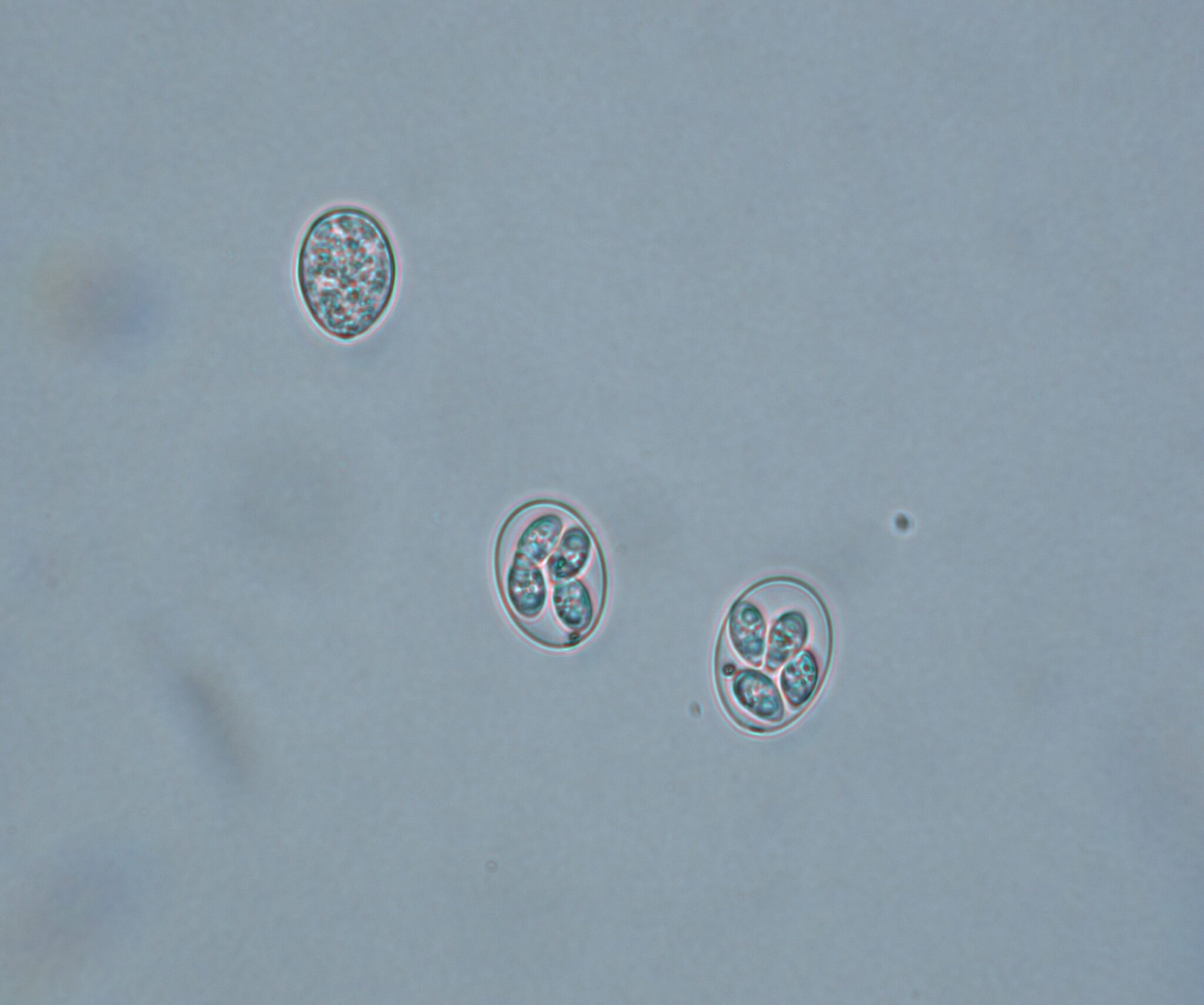 Turkey coccidiosis: Understanding highly pathogenic Eimeria species in ...